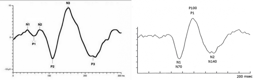 Elettrofisiologia - Studio Oculistico d'Azeglio