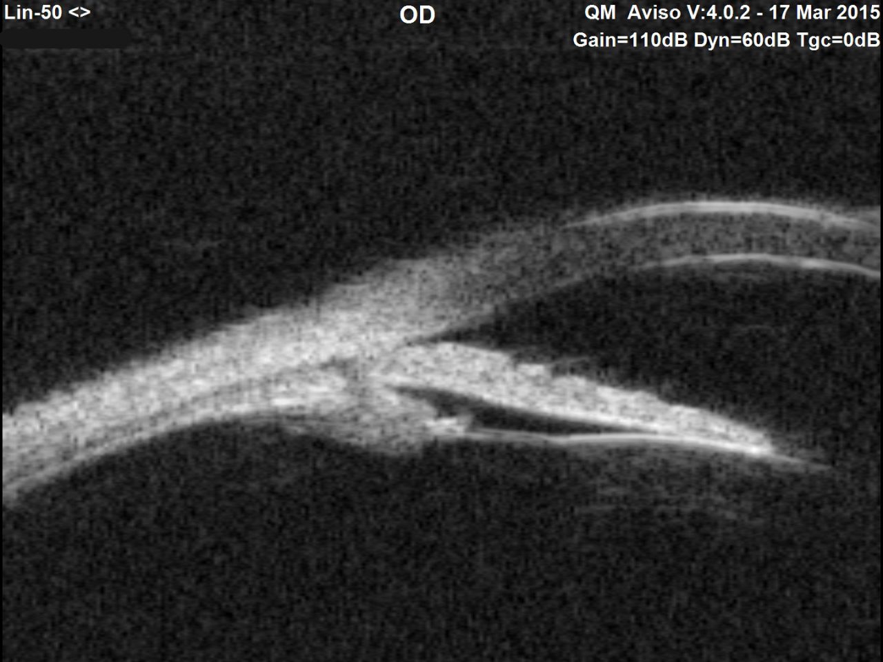 UBM ed Ecografia - Studio Oculistico d'Azeglio