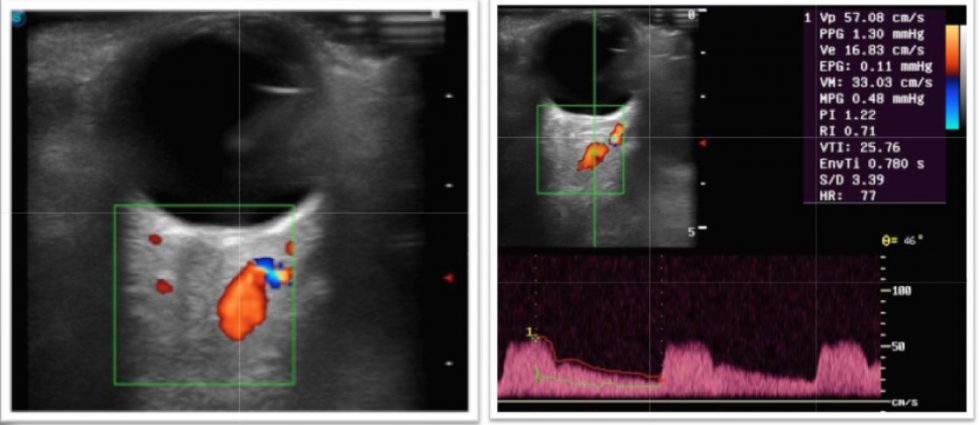 Eco-doppler - Studio Oculistico d'Azeglio