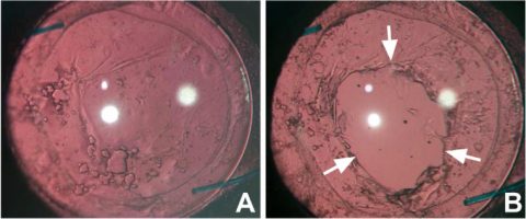 LASER - Studio Oculistico d'Azeglio