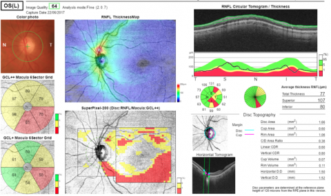 La diagnosi - Studio Oculistico d'Azeglio
